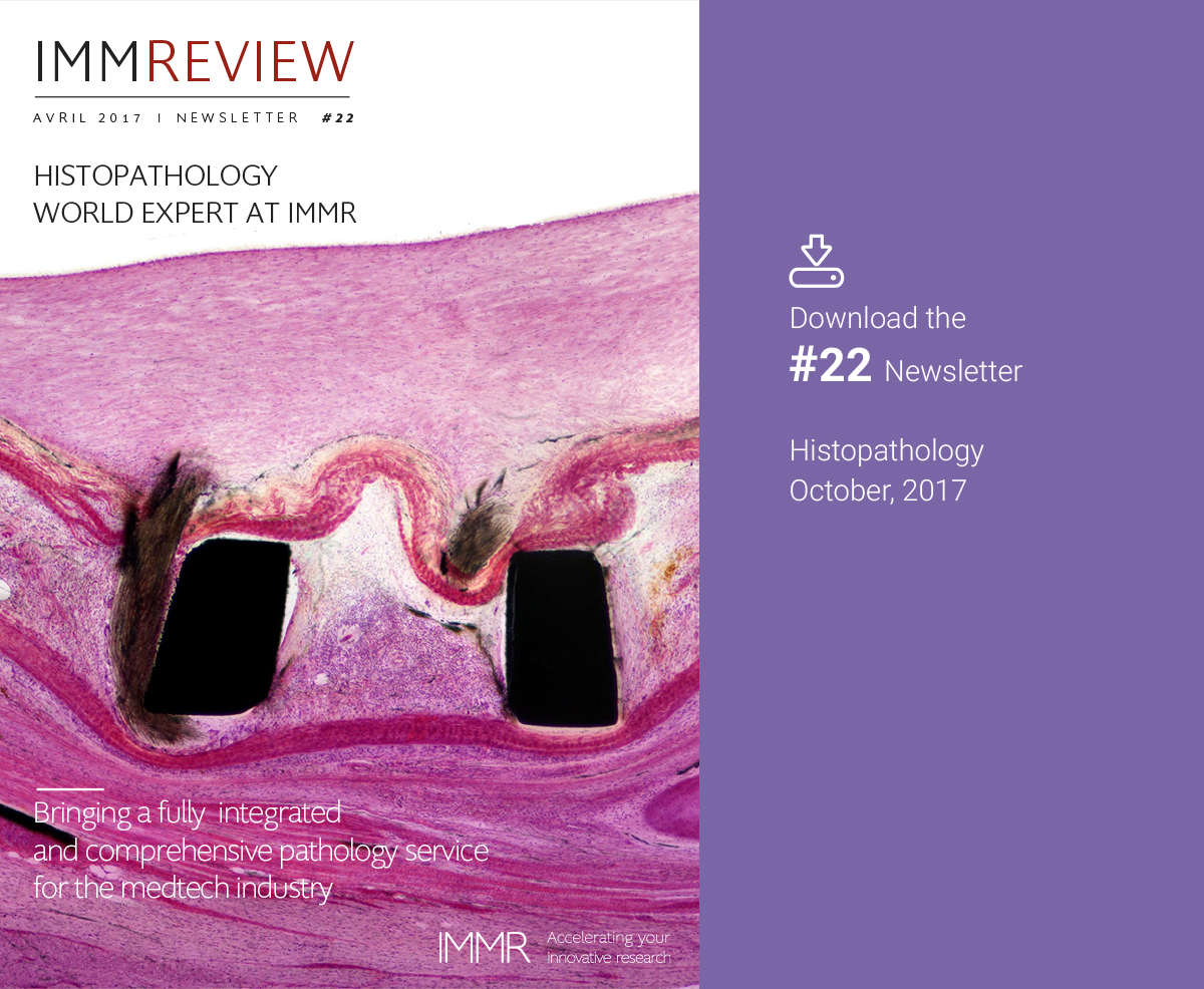 Nos newsletters | IMMR