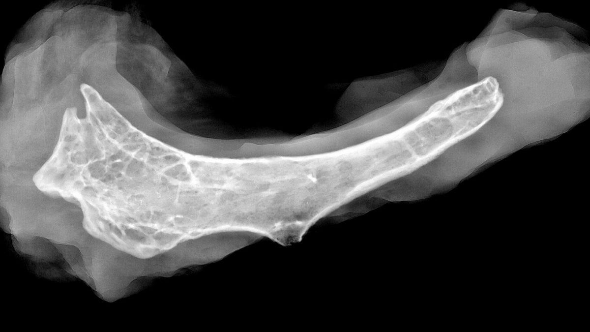 IMMR Image of the Week #1i - IMMR